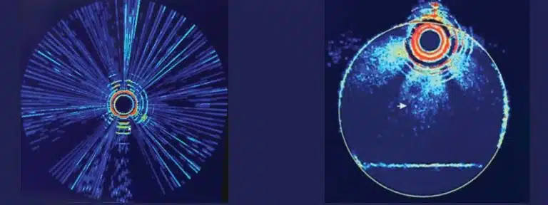 Using Design Drops in Upstream Siphon Manholes